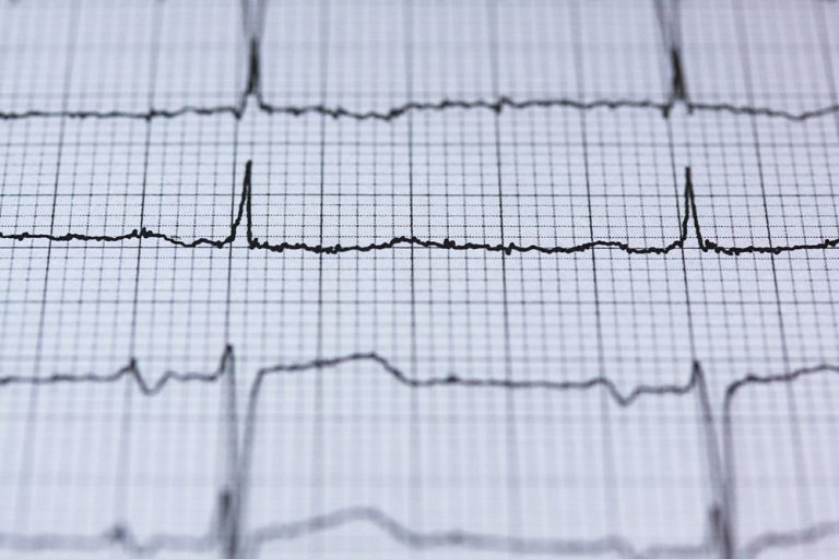 Why Heart Failure Research Is Vitally Important Lower Cholesterol And